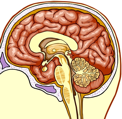 What Happens When a Brain Bleeds? | BrainLine