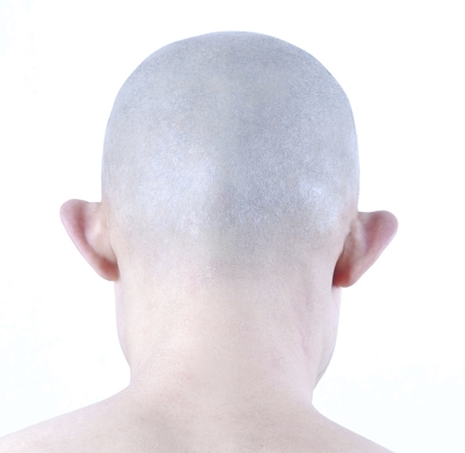 Occipital Neuralgia and Brain Injury | BrainLine