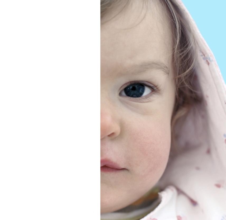 Hemispatial Inattention (Visual Neglect) | BrainLine